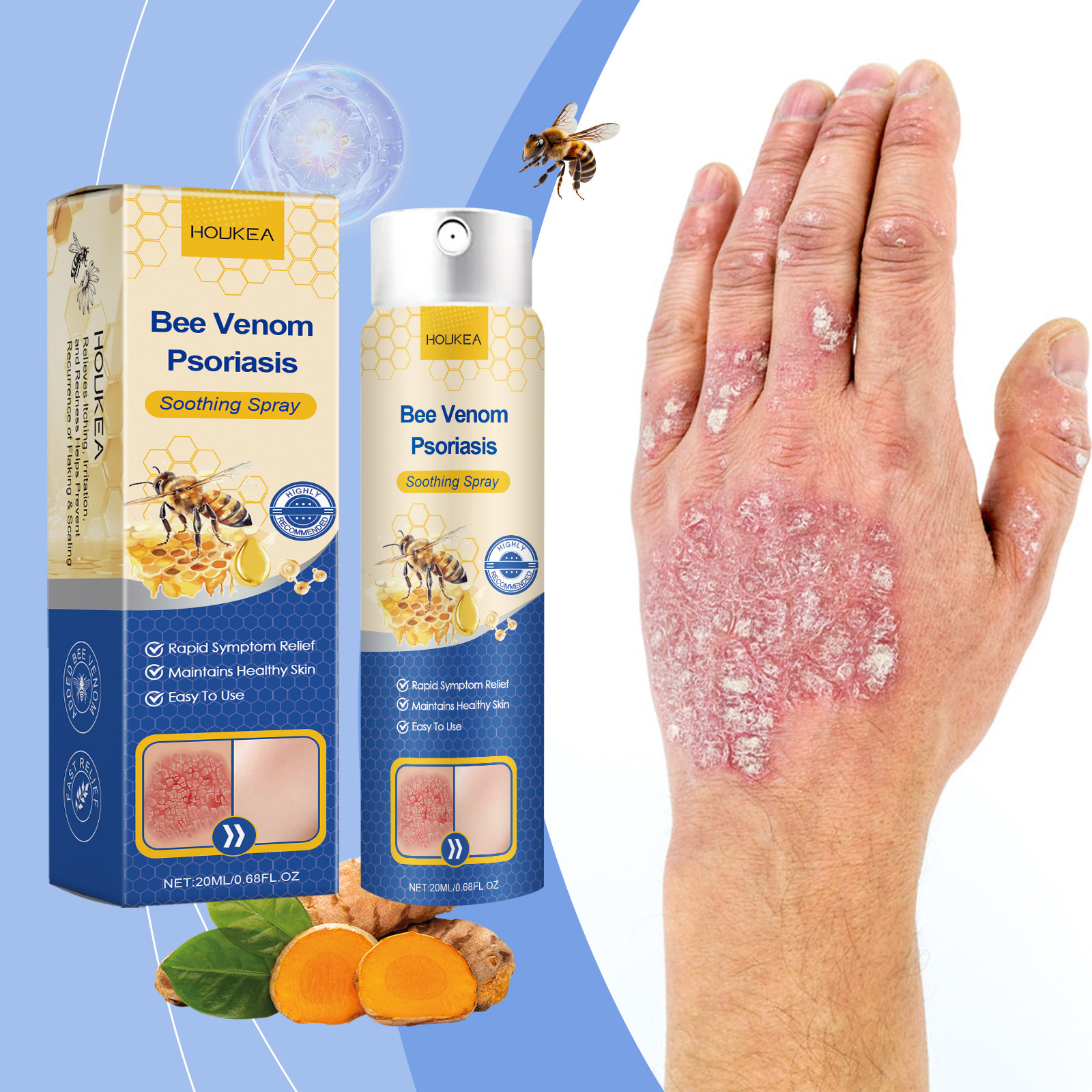 Bee venom psoriasis, treatment of various skin problems, dermatitis ...